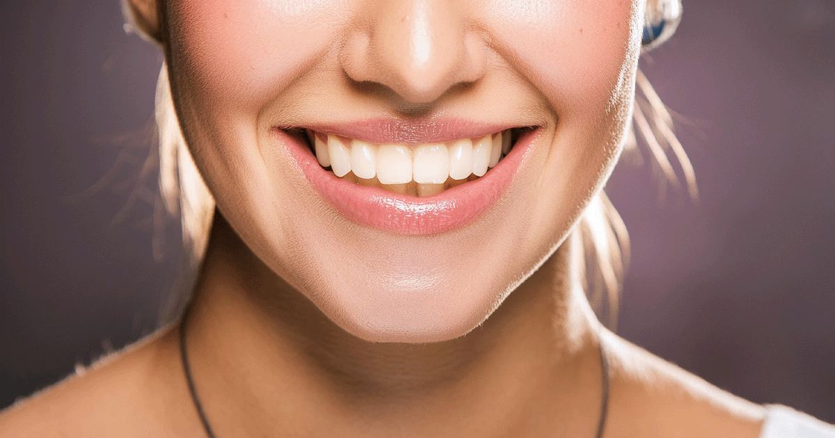 Abfraction in Teeth: Prevention Tips & Tricks - ORAL Dental Studio NYC